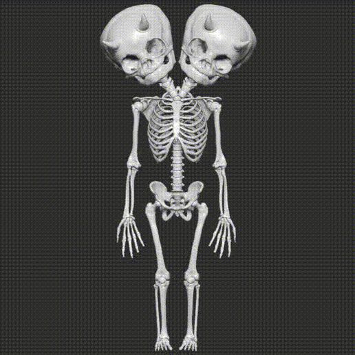 STL file Conjoined Twins Fetal Skeletons 👽 ・3D printable model to download・Cults
