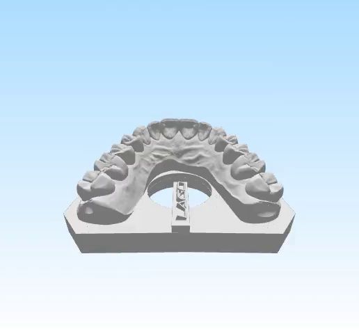 Lago Easthetic Dental Library ( check 3d models at photo Before & After ...