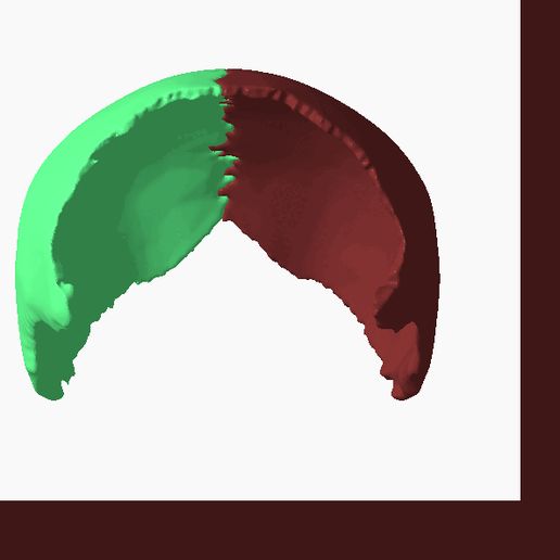 🦴 PARIETAL BONE SEGMENTED MODEL・ 3D File for 3D printing・Cults