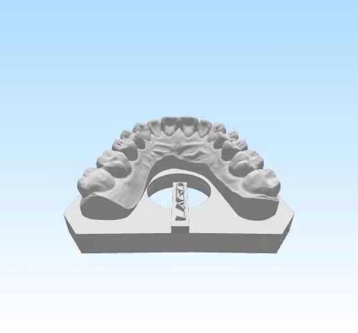 Lago Easthetic Dental Library ( check 3d models at photo Before & After ...