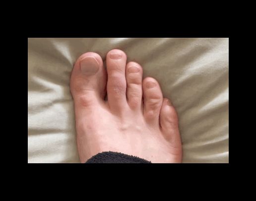 🦶 Toe spacer toe separator・ STL File for 3D printing・Cults